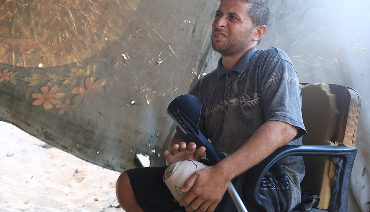 Limbs of Hope | MATW Project